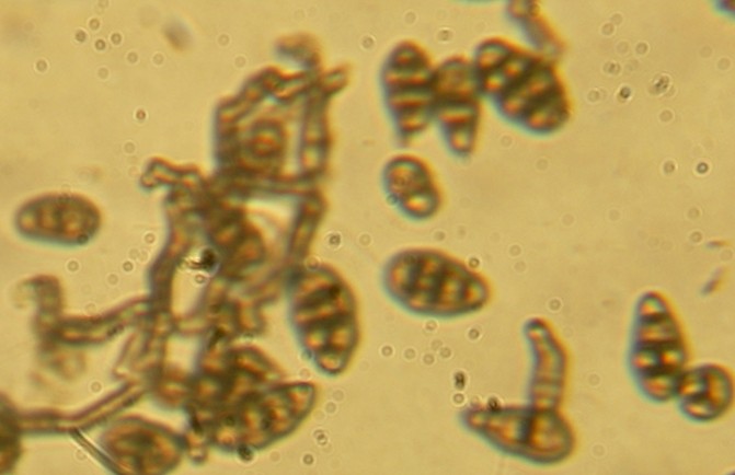 Alpaca Facial Eczema Information - Te Korito Alpacas.